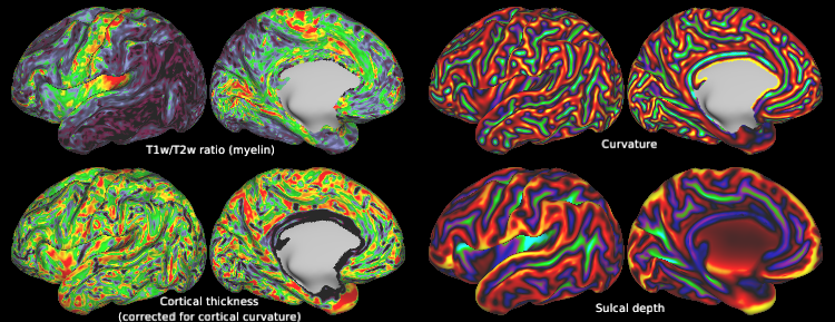 SLCN MICCAI Challenge